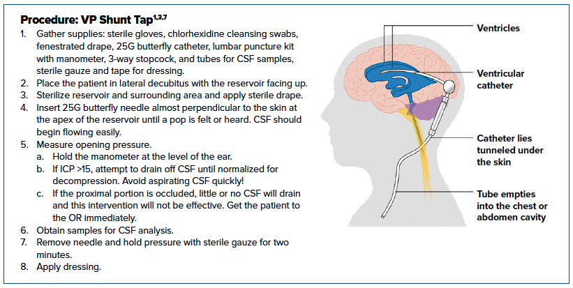 Ventriculoperitoneal Shunt in the ED EMRA Ventriculoperitoneal Shunt in the ED EMRA