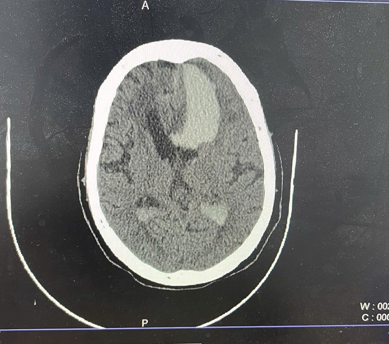 Le Thi Anh Tho, MD EMRA