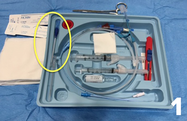 The Use of the Angiocatheter in Central Line Insertion: The Advantage ...