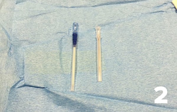 The Use of the Angiocatheter in Central Line Insertion: The Advantage ...