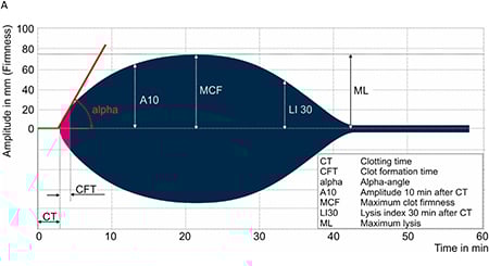 A Simplified Treatment-Based Approach to TEG and ROTEM EMRA