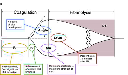 A Simplified Treatment-Based Approach to TEG and ROTEM EMRA