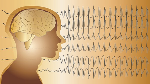Critical Care Alert: Medications for Status Epilepticus - The ESETT ...