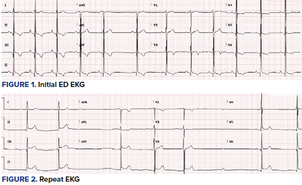 25-Year-Old STEMI: What a Paradox EMRA