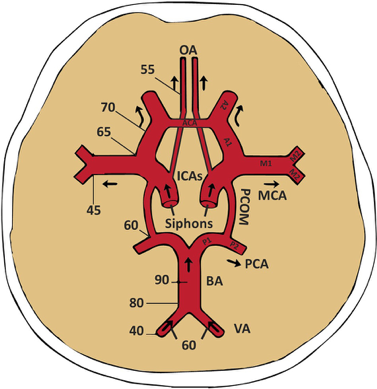 Can Transcranial Doppler Be Useful in the ED? A Review of the ...