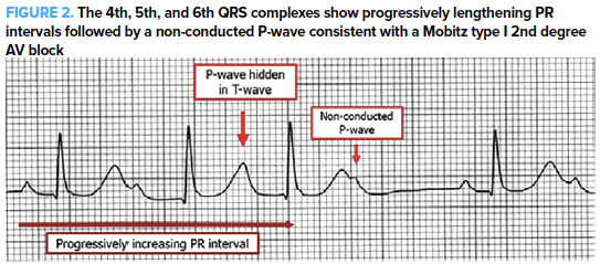 ECG Challenge: August-September 2021 EMRA