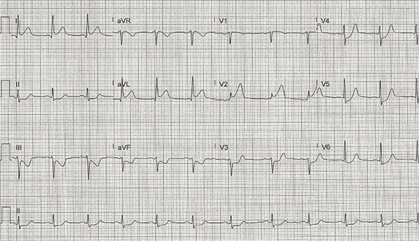 ECG Challenge: October-November 2021 EMRA