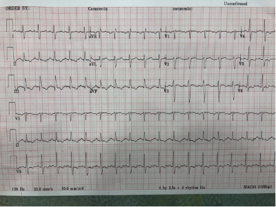 POCUS for the Win: Pulmonary Embolism EMRA