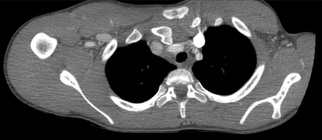 University of Mississippi A131213 EMRA