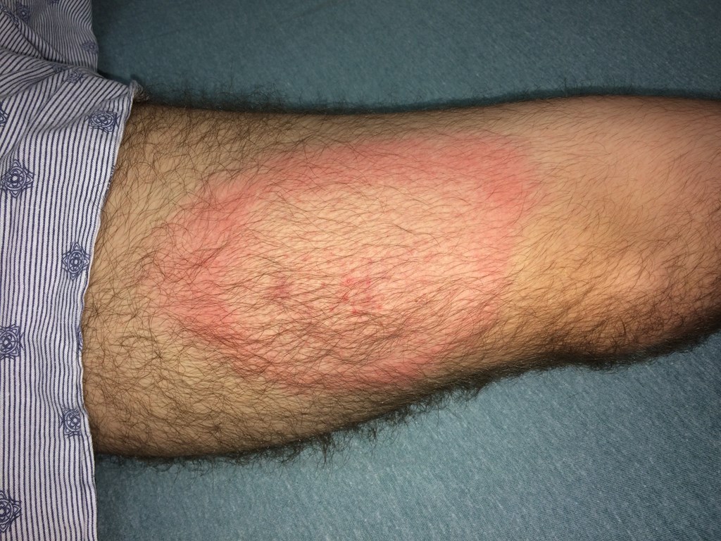 University of Texas SOM at San Antonio A602772 EMRA