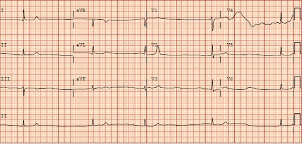 Eastern Virginia (EVMS) Residency EMRA